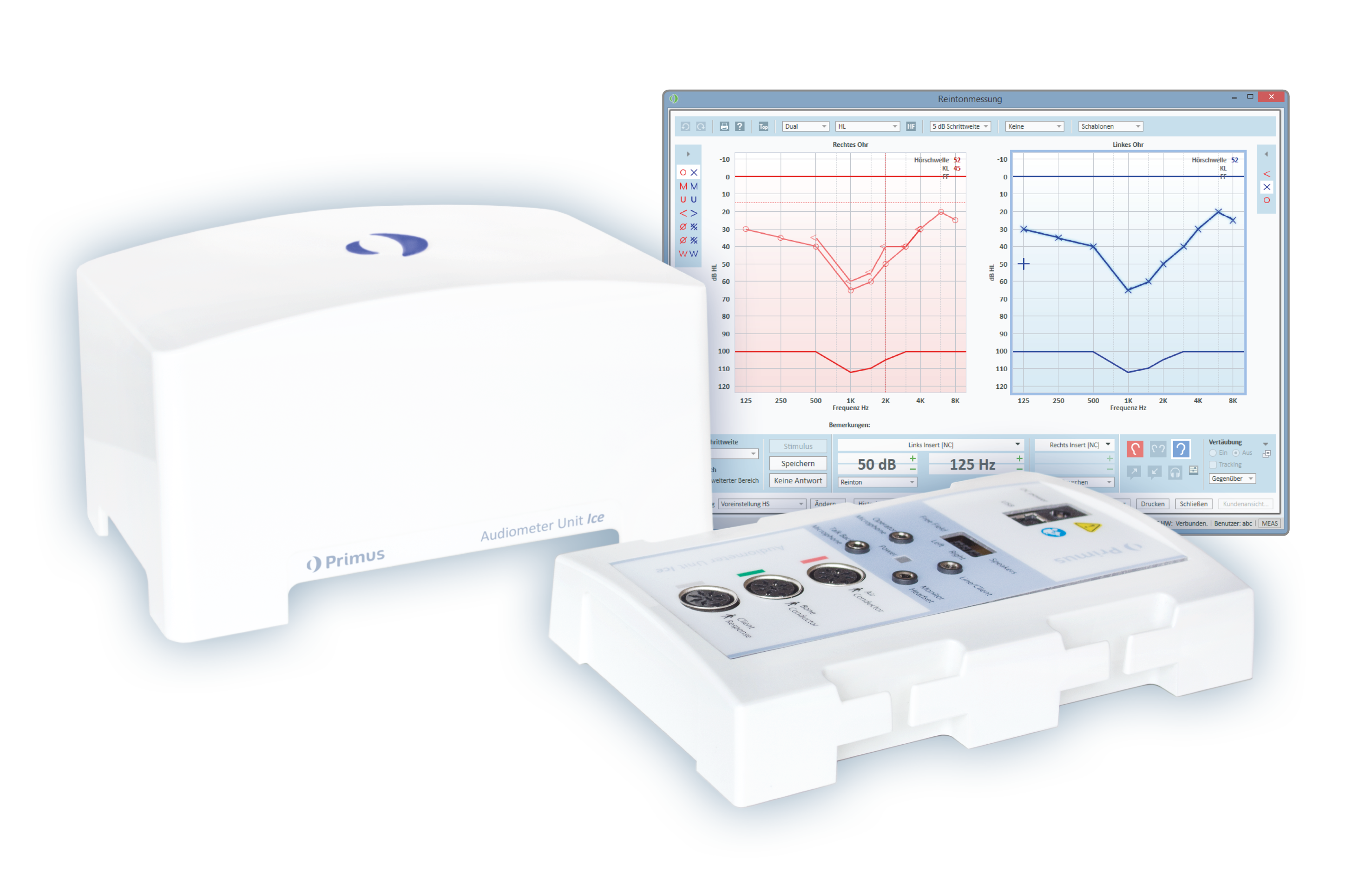 Auditdata das Audiometer für unsere Audio-Flat